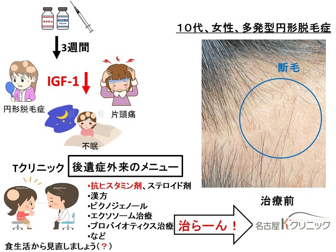 怖い！新型コロナワクチン後遺症；後遺症外来のひどい治療メニューも怖い！！ 患者様からの声・メディア掲載・クリニックからのお知らせ 名古屋